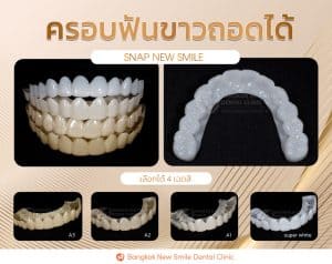 Snap New Smile